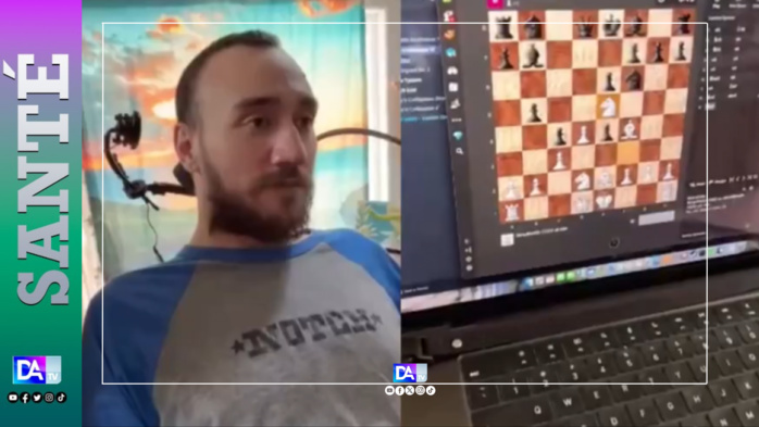 Neuralink : Nolan Arbaugh, le premier cobaye de la puce cérébrale créé ...