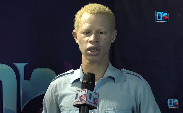 Journée mondiale de l'albinisme / La FNAS lance son cri du cœur ...